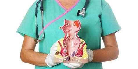 Rectal Prolapse Causes Symptoms Treatment Medicine 2024