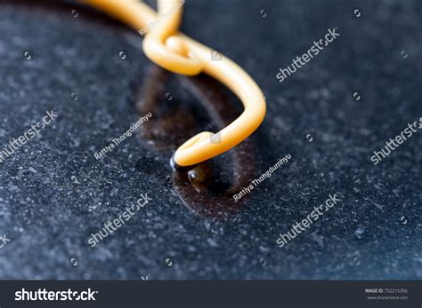 Ascariasis Disease Caused By Parasitic Roundworm Stock Photo 732215356