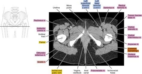 Ct Pelvis Anatomy Muscles Ct Scans Interpretation Principles Basics