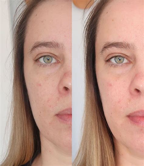 Effaclar Sérum Ultra Concentrado La Roche Posay