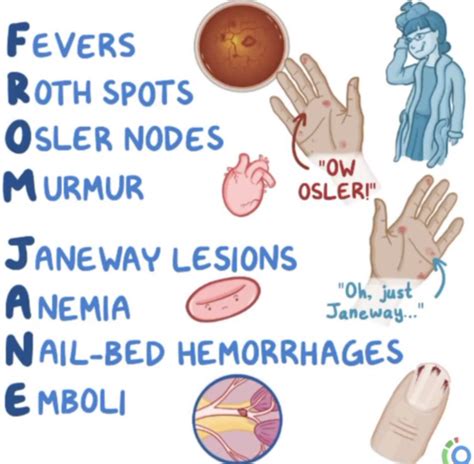 Emergency Medicine Eor Cardiovascular Flashcards Quizlet