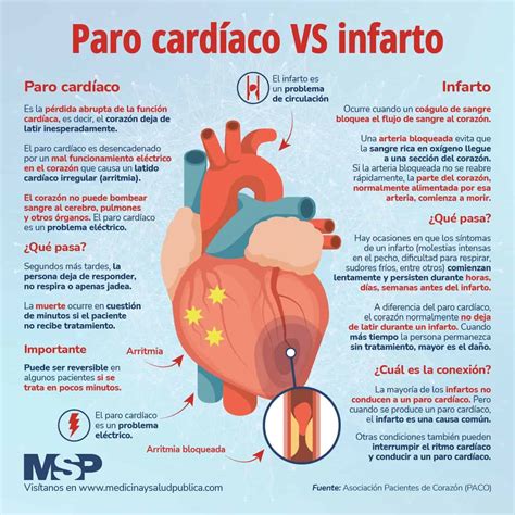 Paro cardíaco VS Infarto Infografía