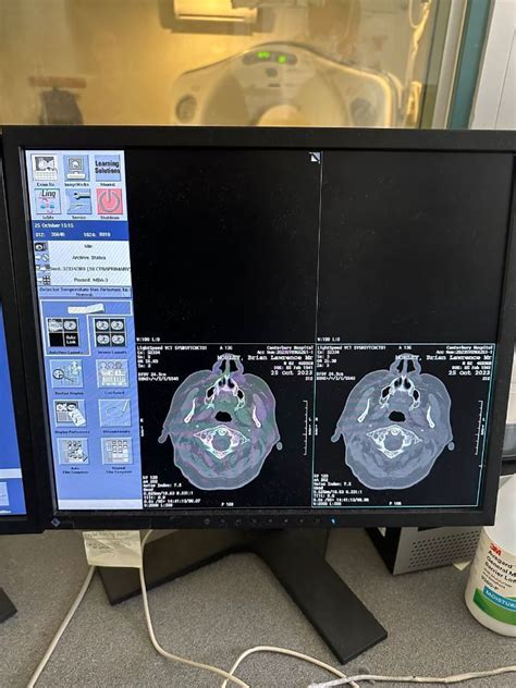 Used Ge Lightspeed Vct Ct Scanner For Sale Dotmed Listing