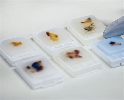 formalin fixed paraffin embedded ffpe tissue discovery life sciences