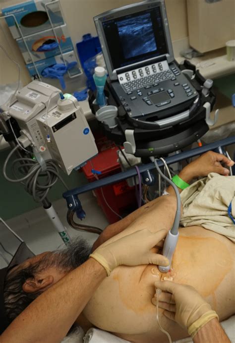PECS SERRATUS Highland EM Ultrasound Fueled Pain Management