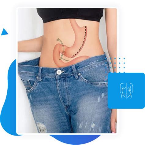 Sleeve Gastrectomie En Tunisie Avantages Et Prix Tout Compris