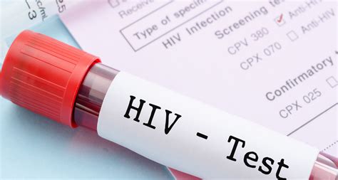 Tests für sexuell übertragbare Krankheiten von Gesundheitsamt