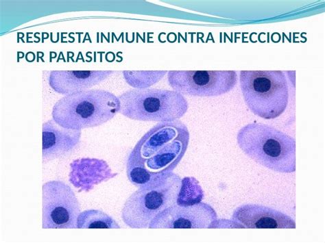 PPTX Respuesta Inmune Contra Infecciones Por Parasitos 2 PDFSLIDE TIPS