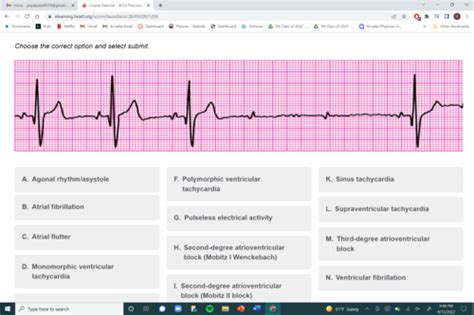 Acls Pre Course Assessment Ekg S Flashcards Quizlet