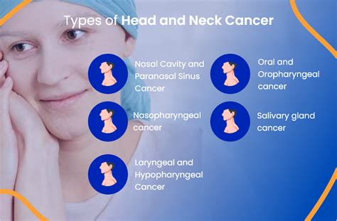 Head And Neck Cancers Types Causes Treatment And Outlook Nbkomputer