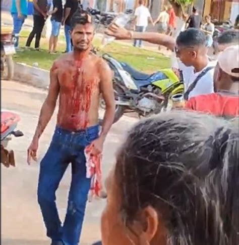 Homem leva facada no pescoço e continua bebendo e fumando no bloco de