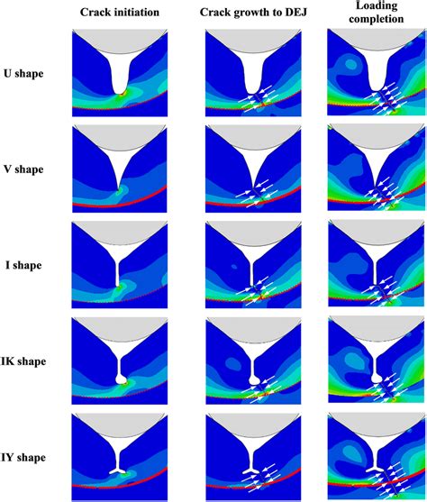 patterns of crack propagation for tooth models and the relevant maximum download scientific