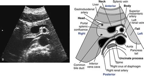Pancreas Ultrasound