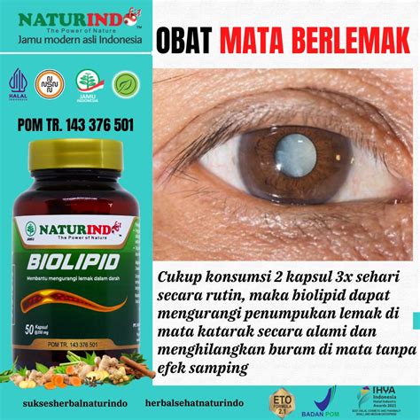 Jual OBAT KATARAK TANPA OPERASI OBAT MATA MINUS MATA BERLEMAK BURAM