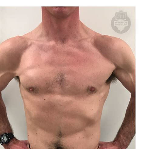 Pectoralis Major Manual Muscle Test