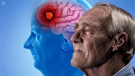 Neuronas Su Muerte Causa Trastornos Y Enfermedades En El Organismo