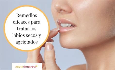 Labios secos y agrietados causas y remedios más efectivos