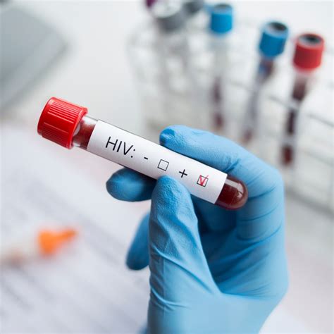 National Hiv Testing Day June National Today