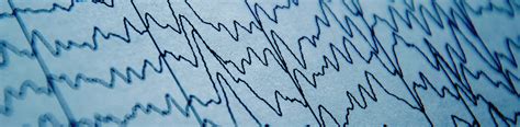 Epilepsy Monitoring Unit Denver Health
