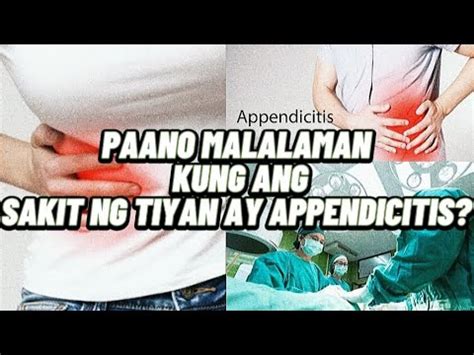 Paano Nga Ba Malalaman Kung Ang Sakit Sa Tiyan Ay Appendicitis Na