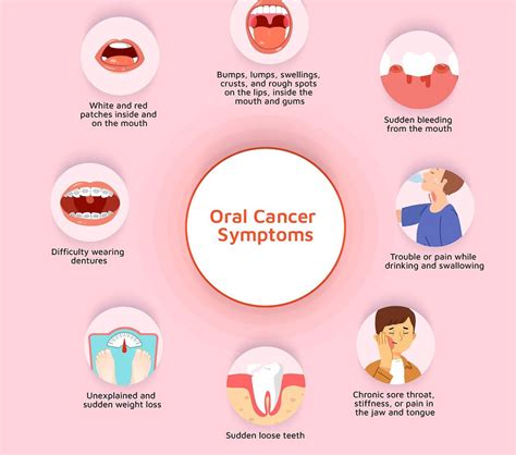 SYMPTOMS AND CAUSES OF ORAL CANCER