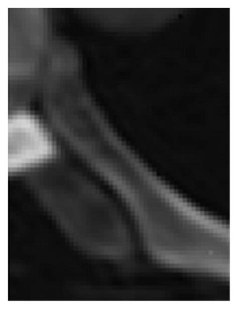 reconstruction of tomographic data wavelet domain a and curvelet download scientific