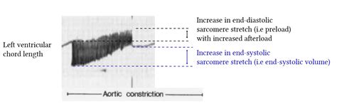 Determinants Of Preload Deranged Physiology