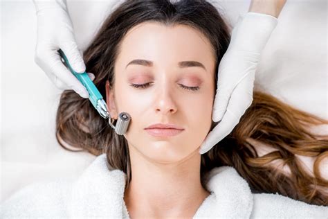 Microneedling Commonly Asked Questions Net Blogz
