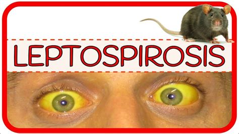 LEPTOSPIROSIS fisiopatología microbiología signos y síntomas