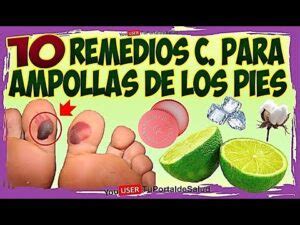 Como Curar Las Ampollas De Los Pies Cavitaciones