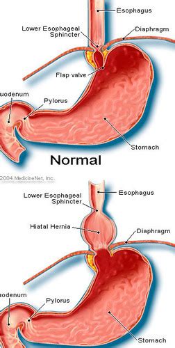 Esophagus Stomach Flashcards Quizlet