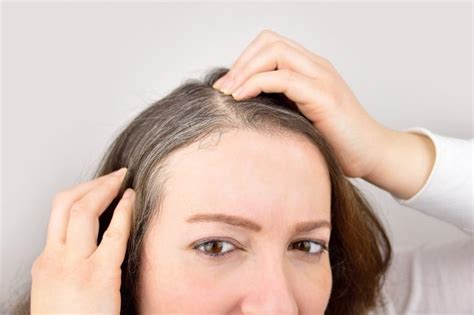 Minoxidil para Mujeres Como aplicarlo y Usarlo GUÍA caída cabello