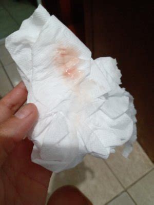 Topo 94 Imagem Corrimento Rosa Pode Ser Gravidez Br Thptnganamst Edu Vn