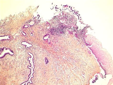 Histopathologie du col utérin atlas numérique