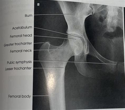 Chapter Pelvis And Hip Comp Test Review Flashcards Quizlet