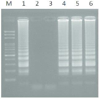 LAMP Amplification Was Conducted Using Extracted DNA From The Leaves Of
