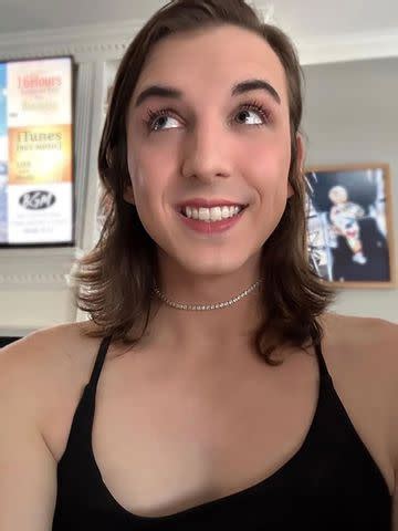 MrBeast S Kris Tyson Shares Before And After Photos Following 1 Year Of