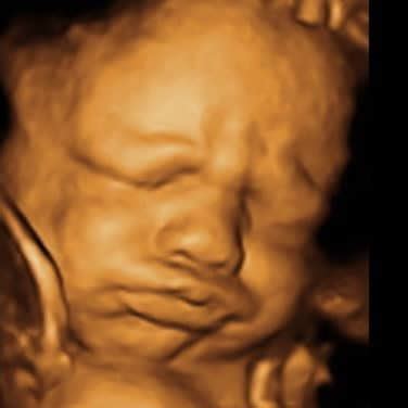 Exames Realizados Fetalmed Medicina Fetal Em Curitiba