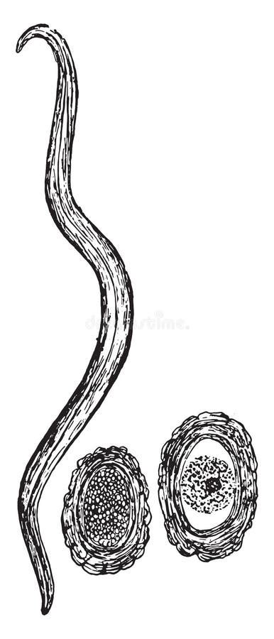 Ascaris Lumbricoides Stock Illustration Illustration Of Organ