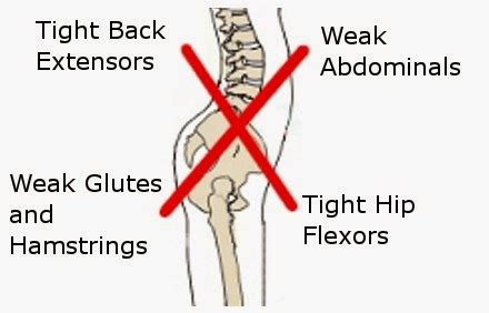 Practicing Posterior Pelvic Tilt POST COMPETITIVE INSIGHT