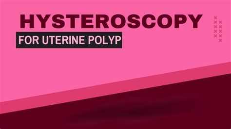 Efficient Hyterescopy Swift Diagnosis Treatment Of Uterine Polyps