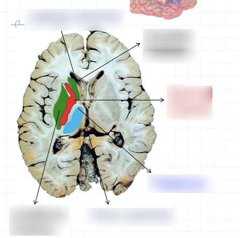 Basal Ganglia Diagram Quizlet