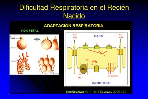 PPT DIFICULTAD RESPIRATORIA EN EL RECIEN NACIDO PowerPoint