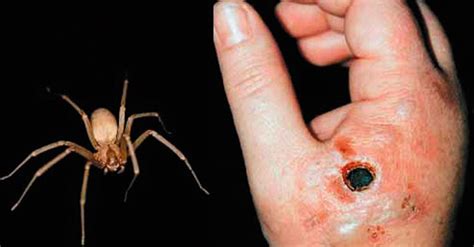 ARAÑA VIOLINISTA 6 Cosas que debes Saber Guía completa