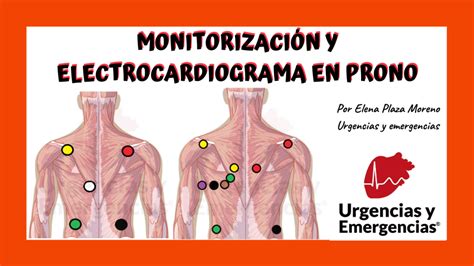 Monitorizaci N Y Electrocardiograma En Prono Urgencias Y Emergencias