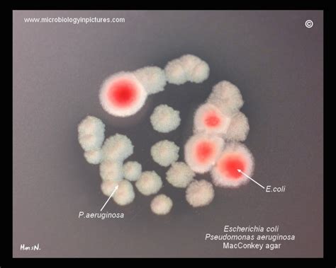 E Coli And Pseudomonas Aeruginosa Colony Appearance On MacConkey Agar
