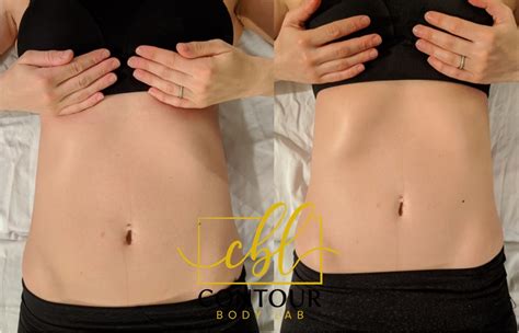 Brazilian Lymphatic Drainage Massage Contour Academy