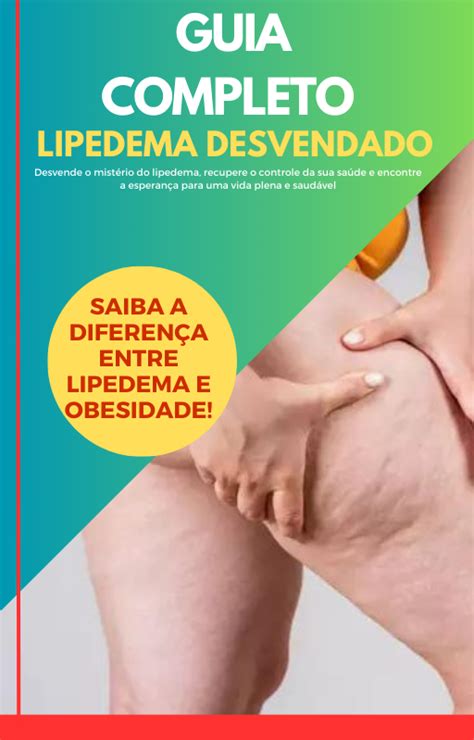 Entendendo O Lipedema Um Guia Abrangente Para Pacientes Mateus Souza