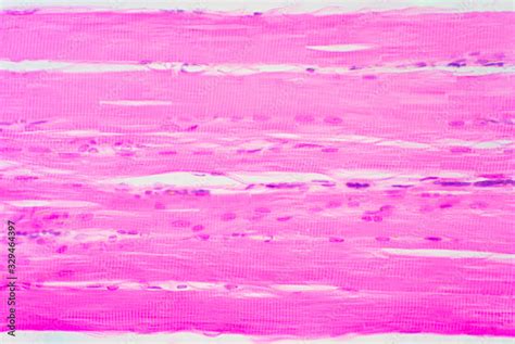 Human Skeletal Muscle Under Microscope View For Education Histology