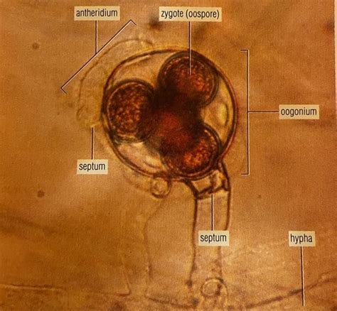 BIO 104 Practical Fungi Flashcards Quizlet